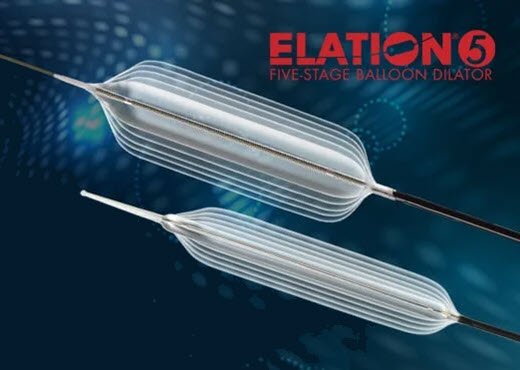 Merit Medical Endotek®lanza el nuevo balón de dilatación Elation5 ...